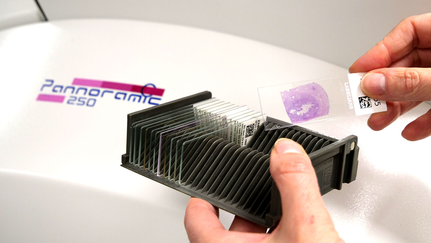 Des scanners de lames accessibles aux chercheurs - Centre Henri Becquerel